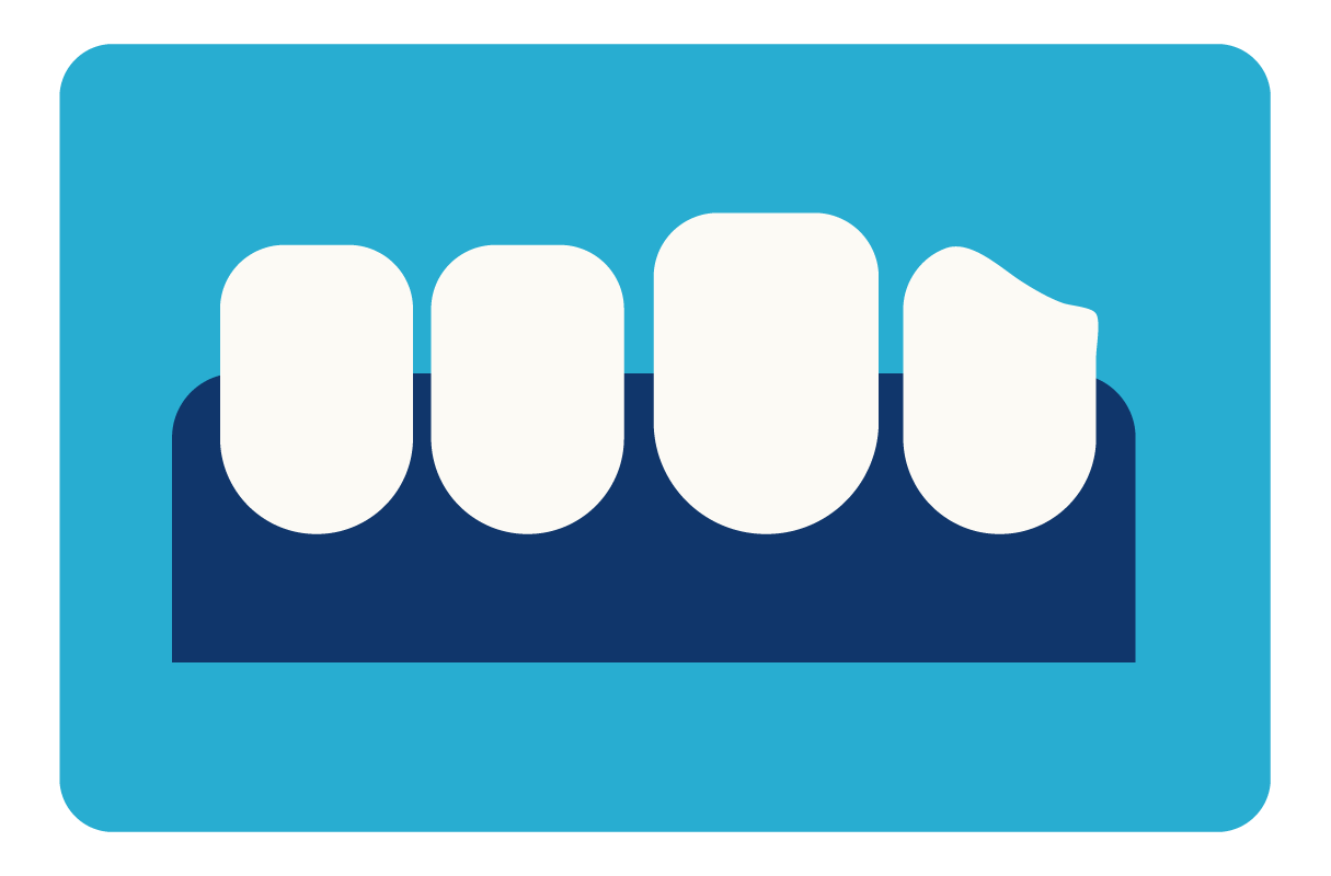 Smile Makeover in Singapore - Gentle Smile Dental Studio