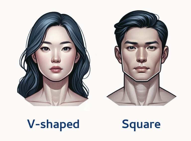 Square Jaw - Gentle Smile Dental Studio